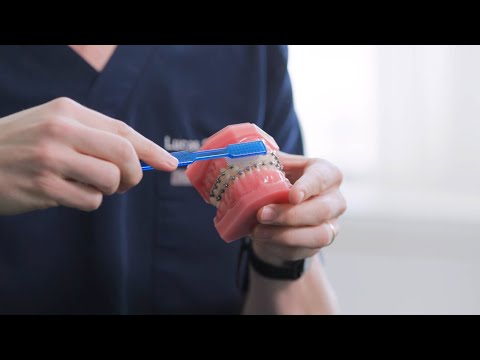 Braces Aftercare & Next Steps with Dr. Luke Shapiro | NYC Orthodontist