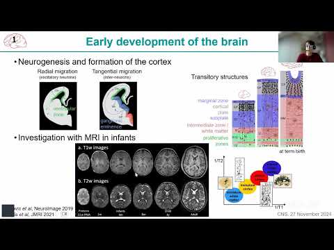 #CNStalk - Jessica Dubois on Brain Development the ‘first 1000 days’