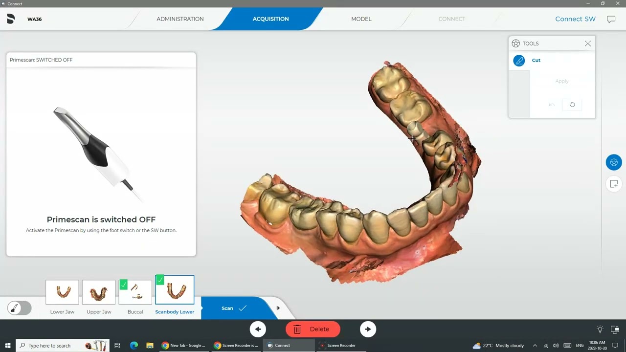 Implant Scanning Techniques