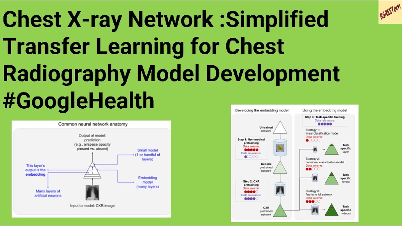 Chest X-ray Network :Simplified Transfer Learning for Chest Radiography Model Development #google