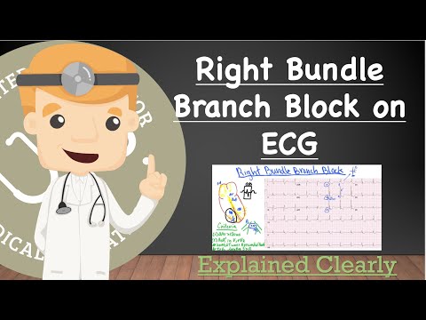 Right Bundle Branch Block on 12 Lead ECG - Identification and Diagnostic Criteria [Actual ECGs!]
