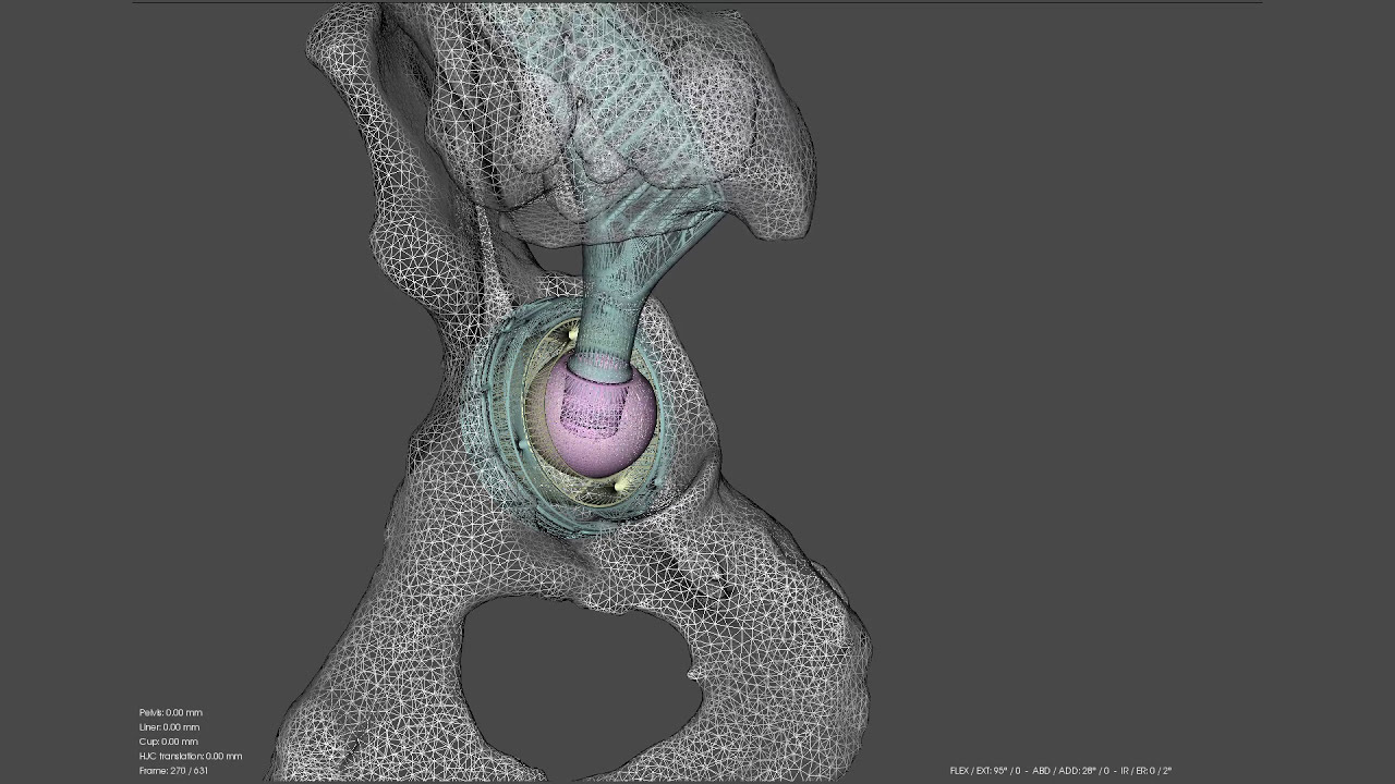 Video Hip Replacement Sex Position Bible Guide Released Shows How To