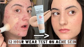 TESTING WET N WILD TINTED HYDRATOR ON ACNE & TEXTURE | 12 HOUR WEAR TEST