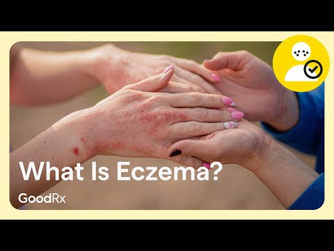 What Is Eczema? A Dermatologist Explains | GoodRx