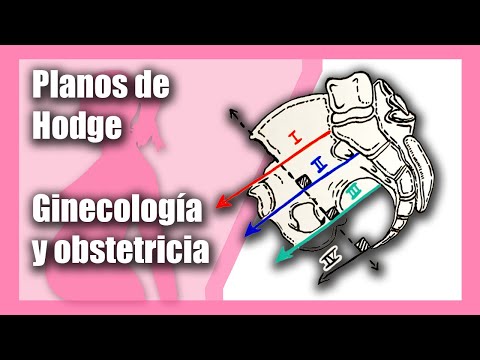 Planos de Hodge | Ginecología y obstetricia (Andrés Samaniego)