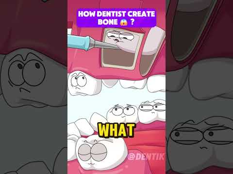 Why Do Dentists Do Sinus Lifts? 🤔💭 (Dental Implant Explained!)