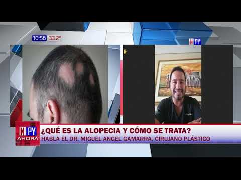 ¿Qué es la alopesia y cómo se trata?