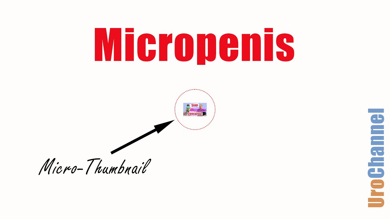 Stop Micropenis Concerns! | UroChannel