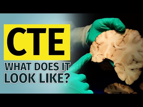 HOW DOES CTE APPEAR IN OUR BRAIN #shorts