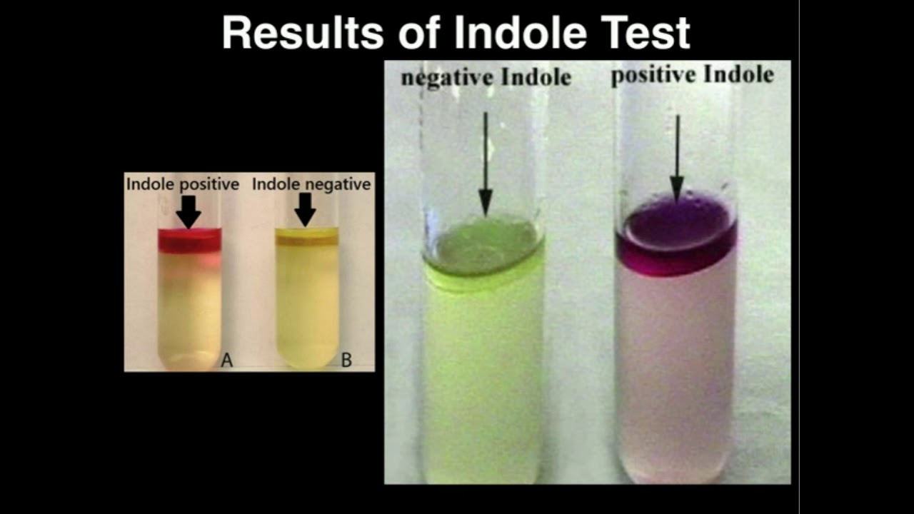 Microbiology: Indole Test (Tryptophanase)