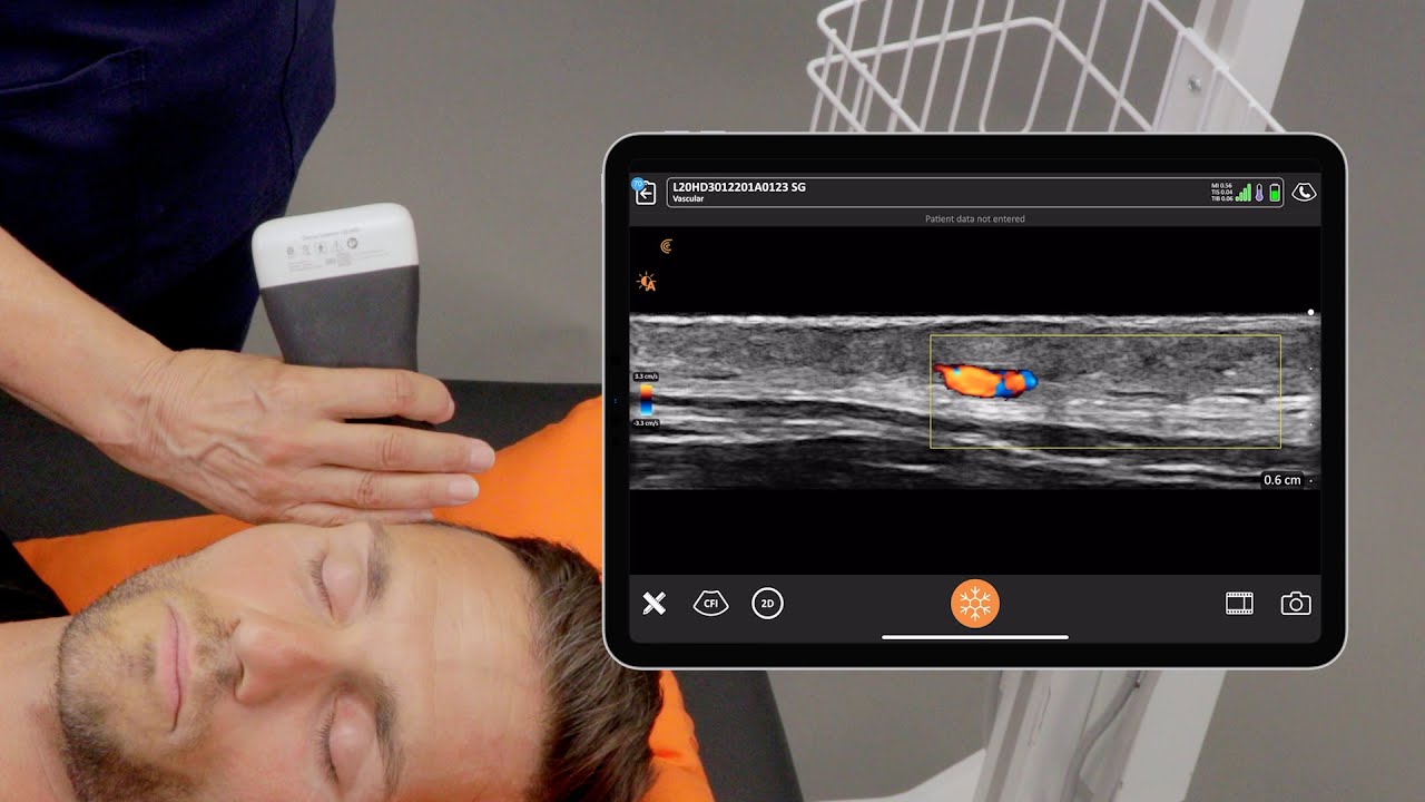 Temporal Artery Evaluation