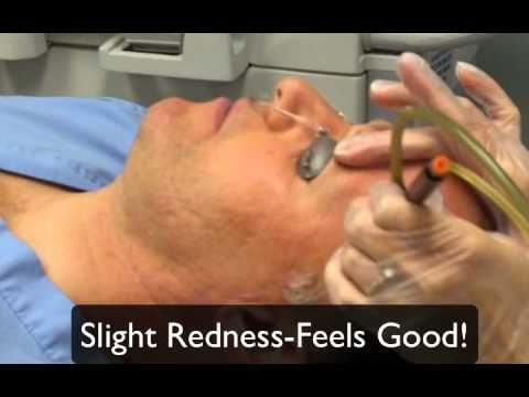 drdermalinfusion.mov