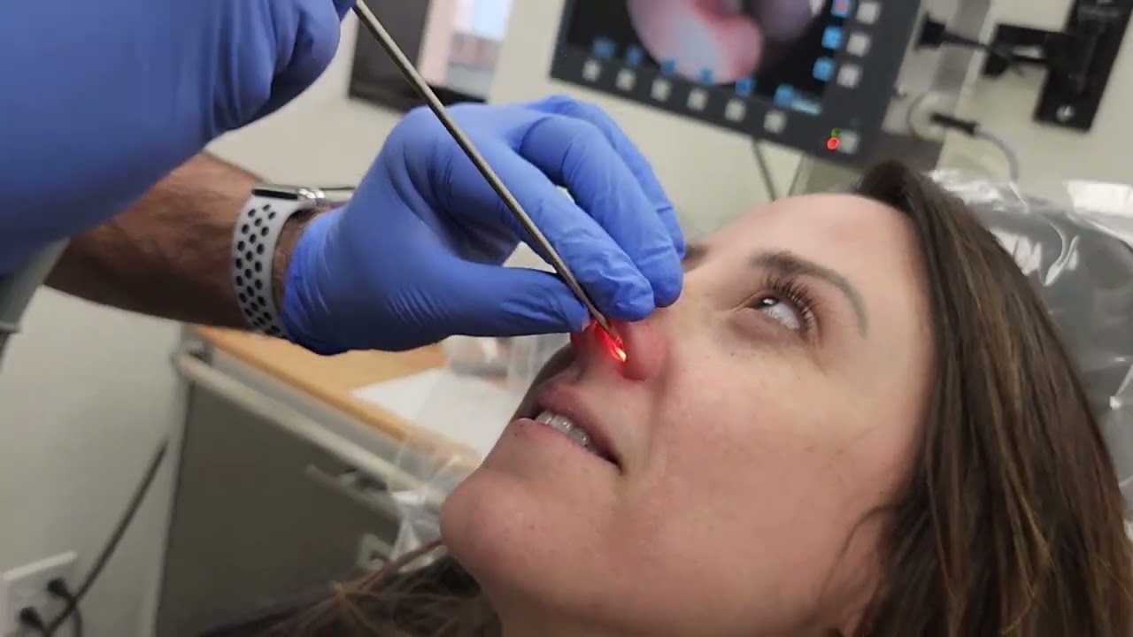 Las Clinicas ENT del Doctor Nariz - Sinusitis y Ronquido