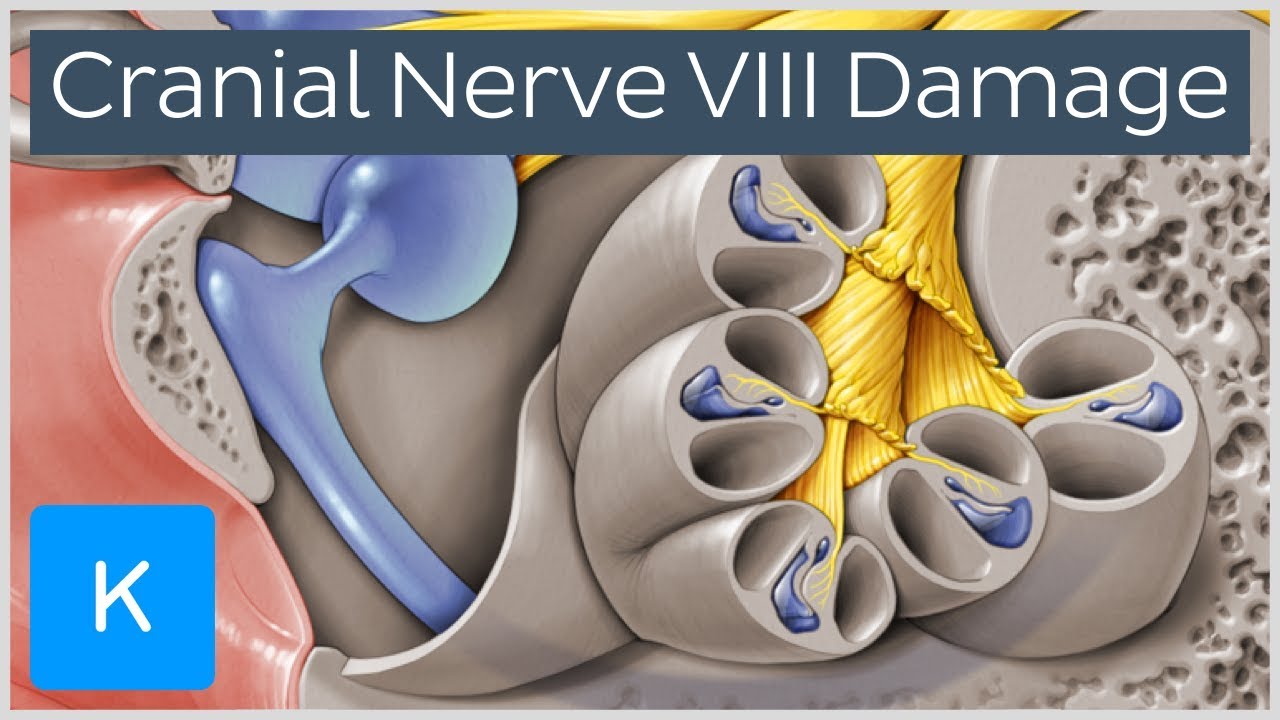 What happens when the vestibulocochlear nerve is damaged? - Human Anatomy | Kenhub