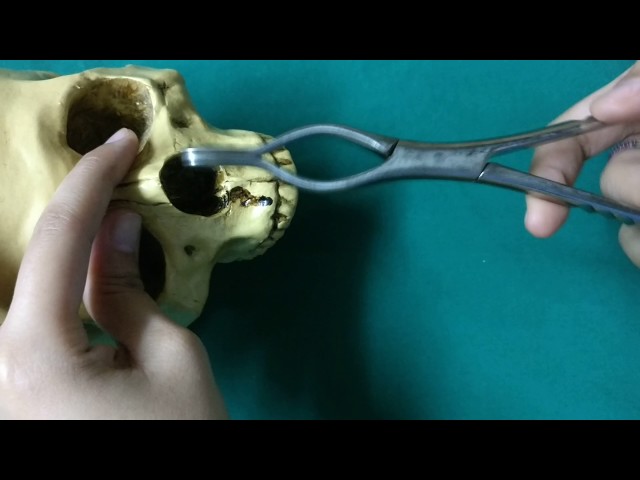 Medical Forceps - Ash Septum Forceps Trader - Retailer from Nashik