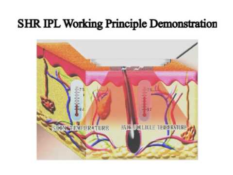 See the Details of New IPL SHR Super Hair Removal and Skin Rejuvenation Device