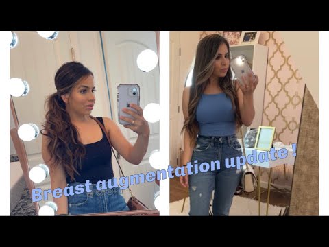 Breast Augmentation Update/ 365cc Chitchat