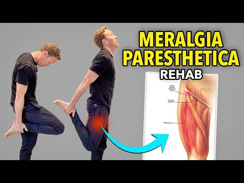 3 Femoral Nerve Exercises (Meralgia Paresthetica)