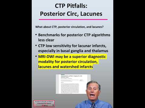 Posterior Circulation and Lacunar Infarcts: Neuroimaging in Acute Ischemic Stroke Patients 54
