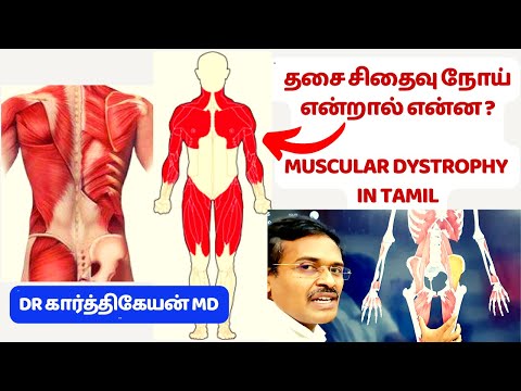 தசை சிதைவு நோய் என்றால் என்ன ? | muscular dystrophy in tamil