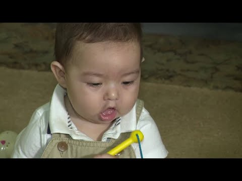Complications caused by cleft palate; what doctors can do to correct it