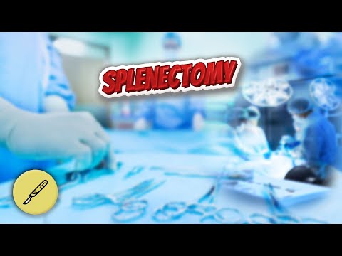 Splenectomy - Everything Surgeries ✅😬⁉️