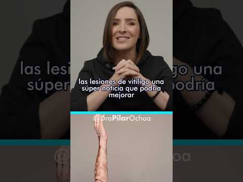 NEW DRUG FOR VITILIGO - Dr. Pilar Ochoa #shorts #dermatology #vitiligotreatment