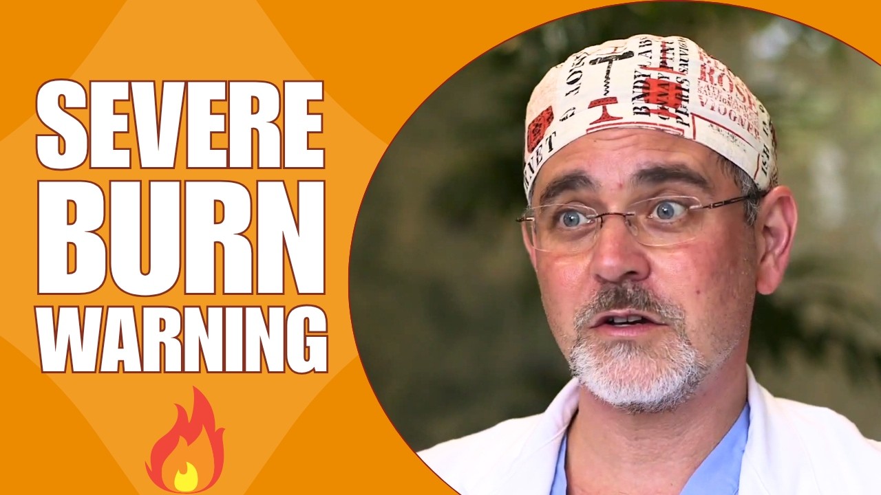 What is a third degree burn? Expert advice on treatment & recovery