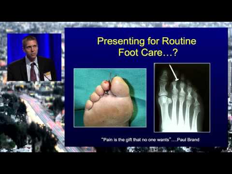 Special Ops for LOPS: Can Neuropathy Surgery Cure Neuropathic Ulcers?
