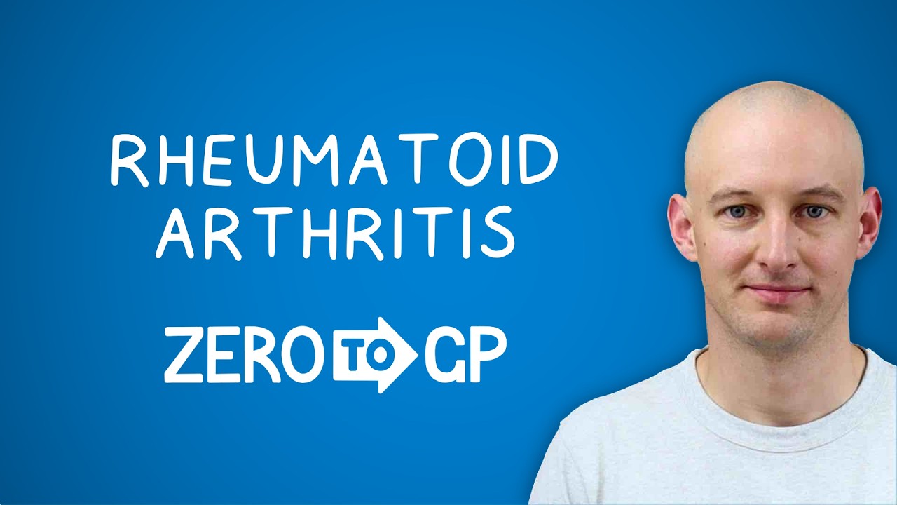 Rheumatoid Arthritis - Essential GP Revision