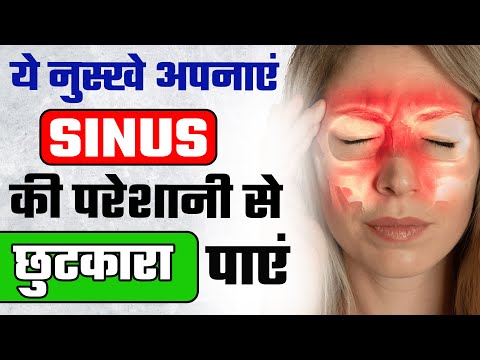 Sinus Treatment Home Tips | Sinusitis ka Gharelu Upchar | Sinus Treatment Home Tips In Hindi