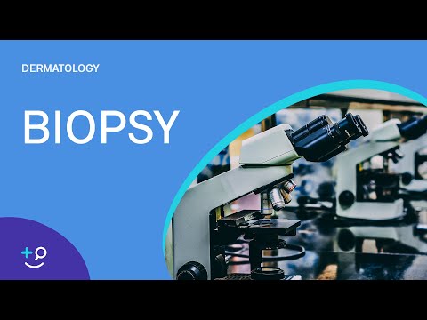 Biopsy Procedure – Colorado Dermatology Institute