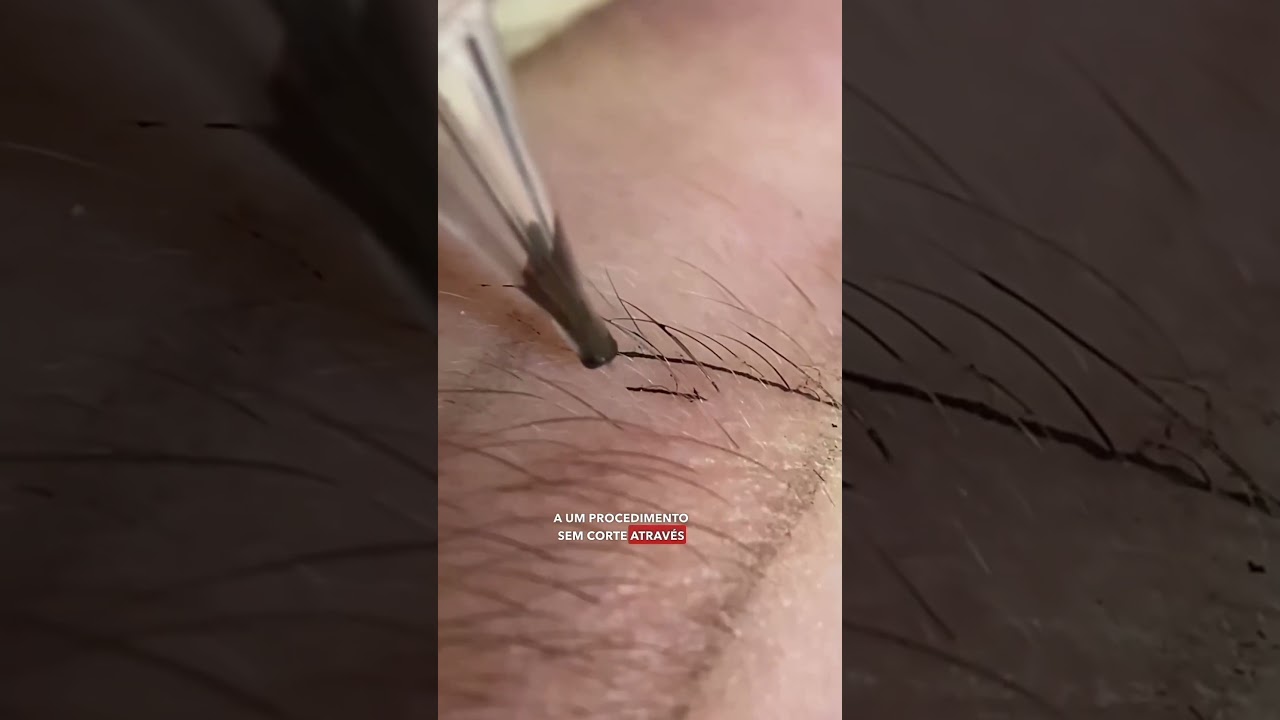 O Método de Micropigmentação que Toda Cliente Deseja! #shorts