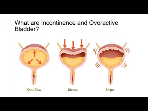 Managing Prostate Cancer Treatment Side Effects