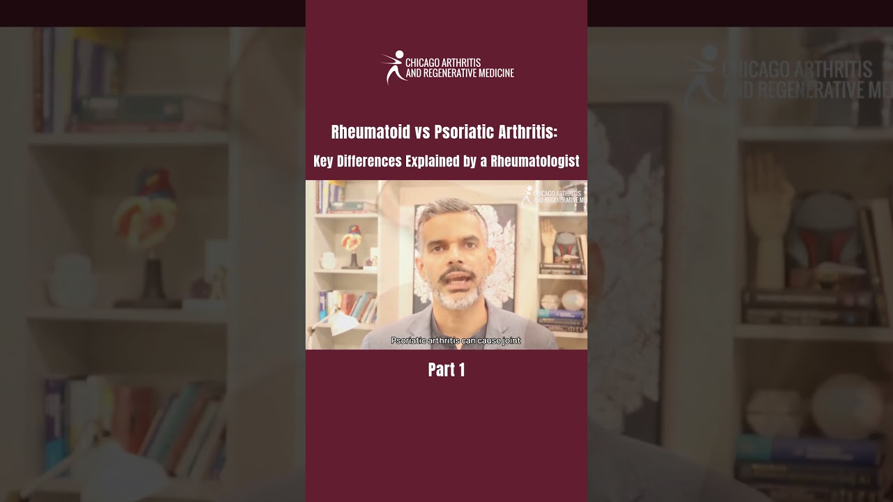 Rheumatoid vs Psoriatic Arthritis Key Differences 💢 | PART 1