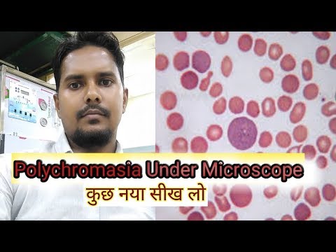 Polychromasia in hindi / Polychromasia on smear