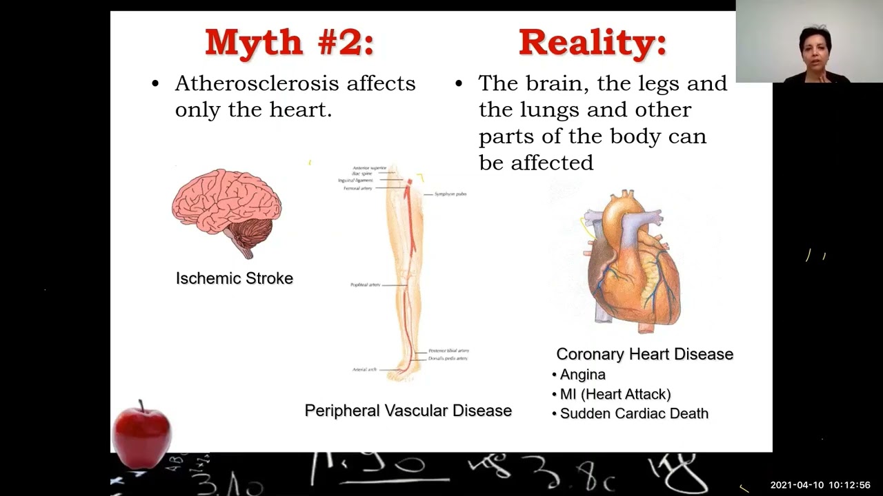 CCC Introduction to Cardiac Rehab Lecture