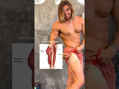 The Tensor Fasciae Latae (TFL) or outer hip becomes tight due to poor posture, prolonged sitting.