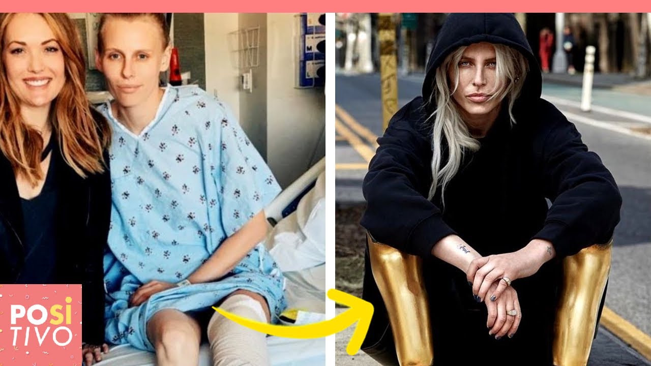Lauren Wasser, la top-model con le gambe d’oro