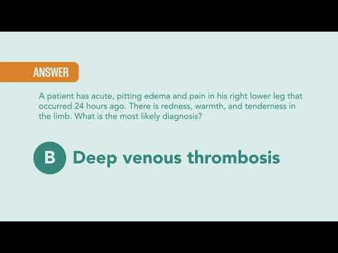 TAKE THE QUIZ | Edema