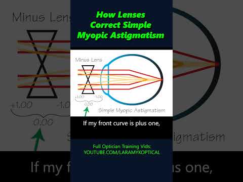 How lenses correct Simple Myopic Astigmatism