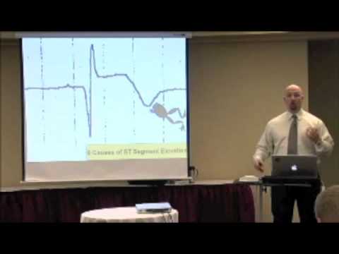 The 6 Causes ST Segment Elevation on an EKG/ ECG