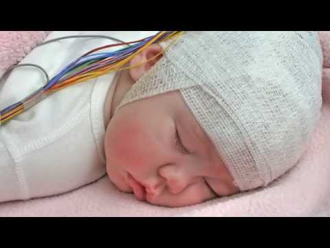 Pediatric Neurology/LTM