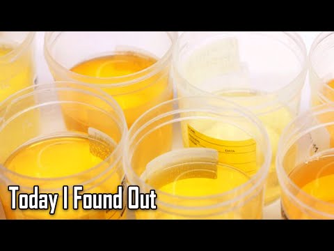 Why Do Vitamins Make Urine Bright Yellow