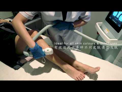 Super Hair Removal (SHR)