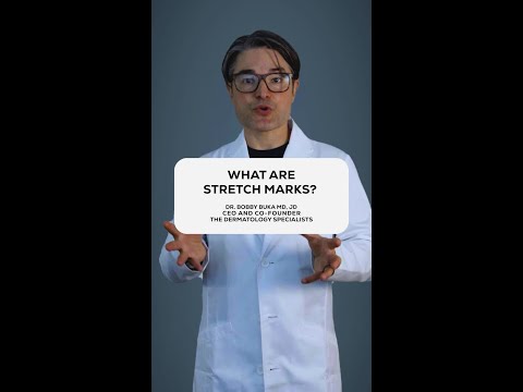 What are stretch marks?
