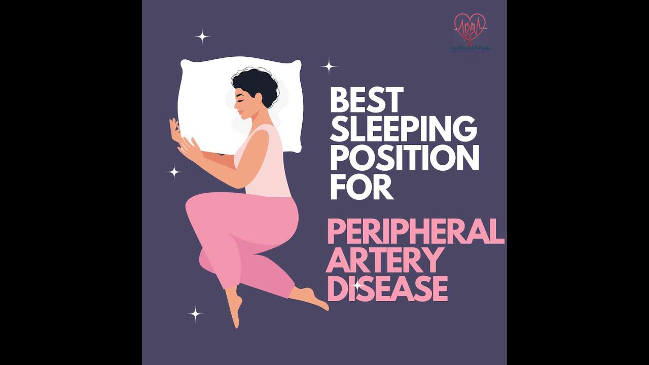Best sleeping position for Peripheral Artery Disease