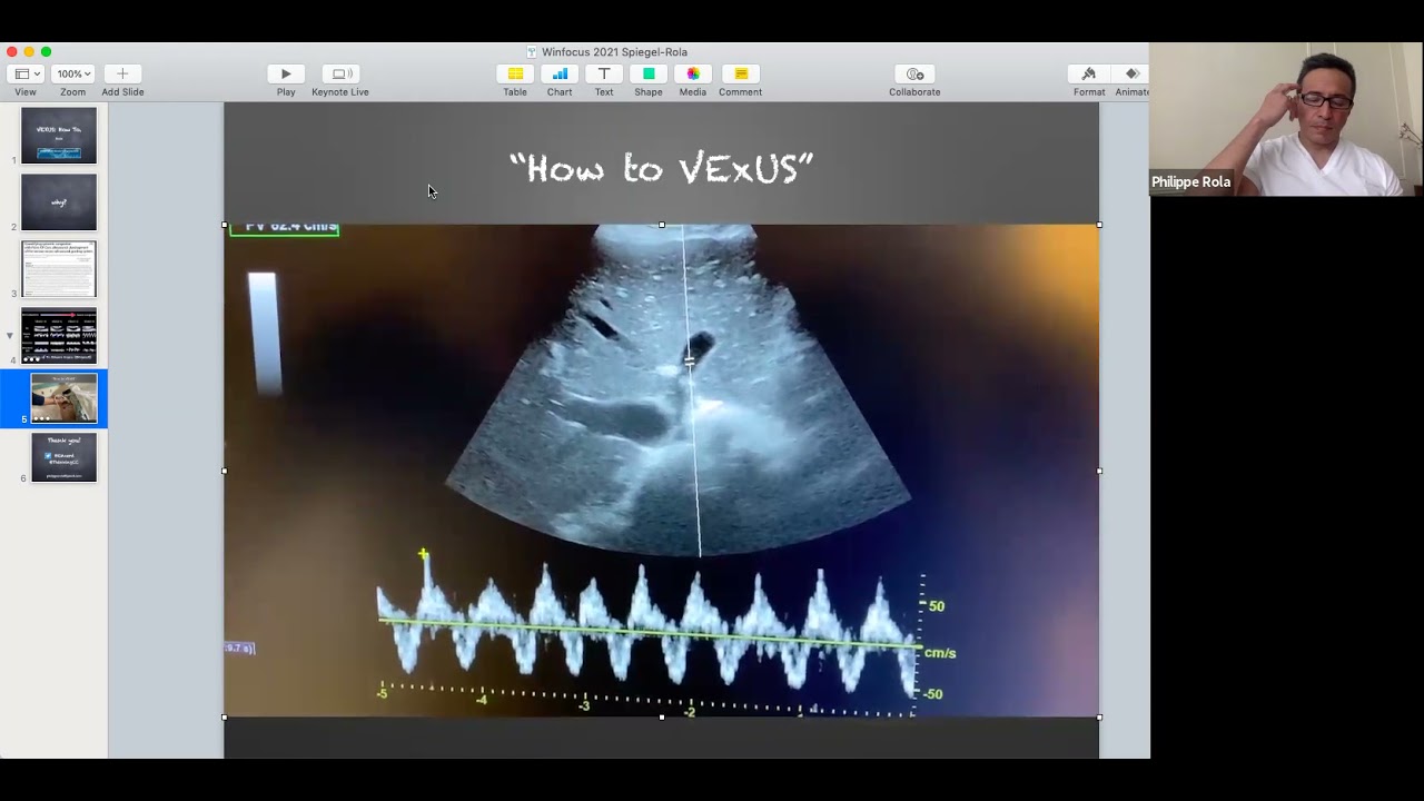 Winfocus | User Videos