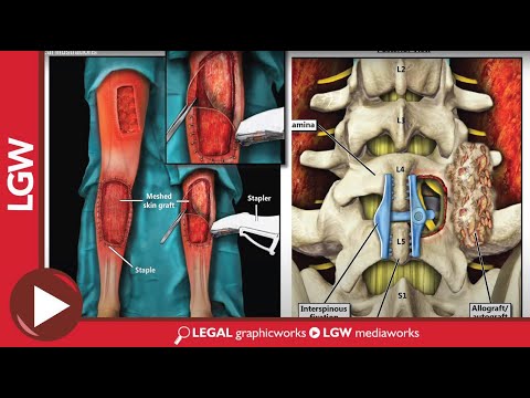 Stock Medical Illustrations