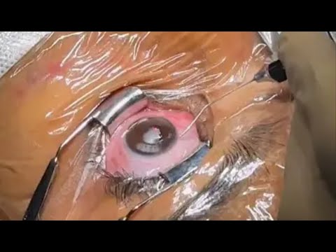 Eye 👀 Hospital Jeddah|| Saudi Arabia||